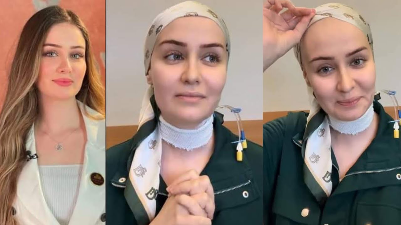 ملكة جمال العراق فيان سليماني: "أكثر شيء أحبه تساقط من أول جلسة كيماوي هو شعري" - الموقع - مجلة ...